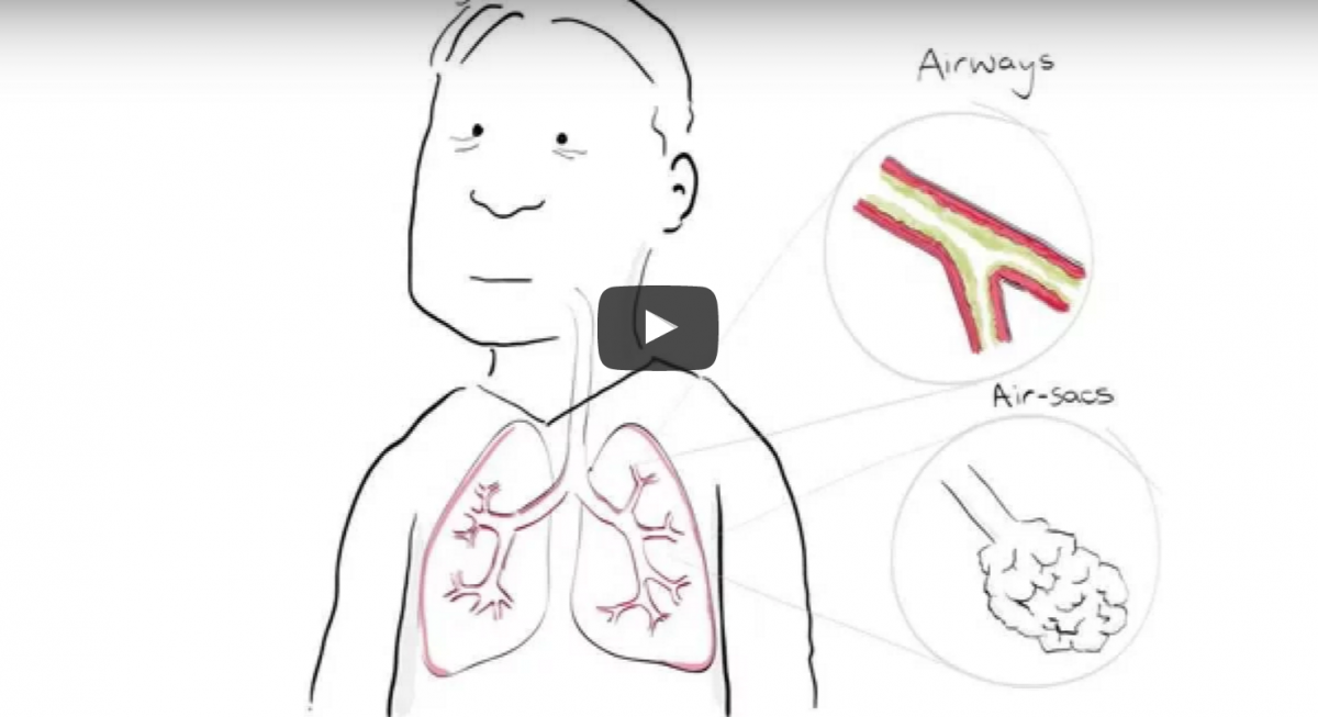 What You Need to Know About COPD | COPD News Today